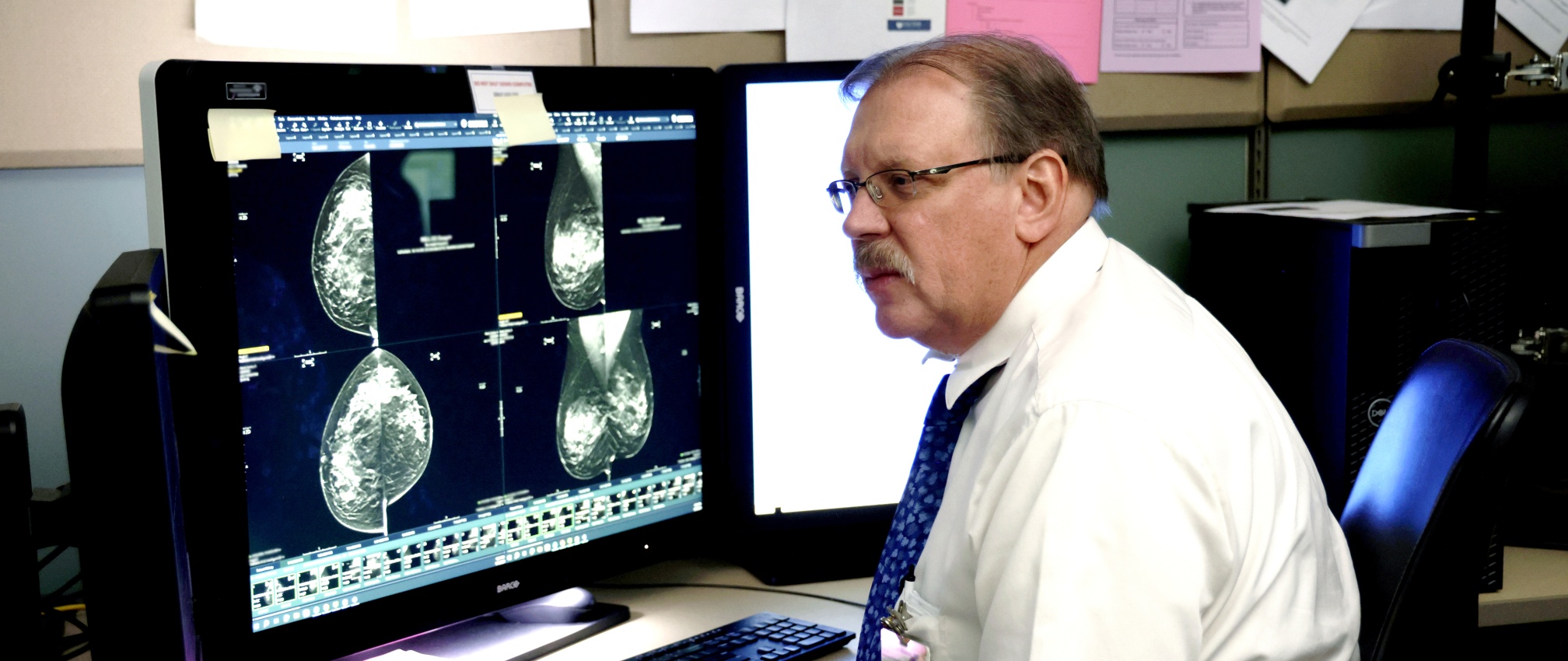 Breast Imaging | Department of Radiology